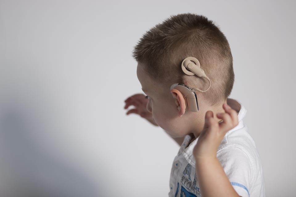 El implante coclear en niños - Hop'Toys
